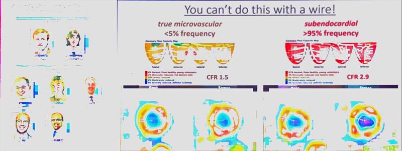 REVISED TRIAL 2022 | Tim Mạch Can Thiệp